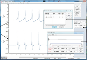 Download What Is Access Resistance In Patch Clamp free - oregonrutor